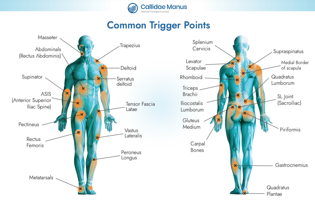 Trigger Points Map – Callidaemanus Portal